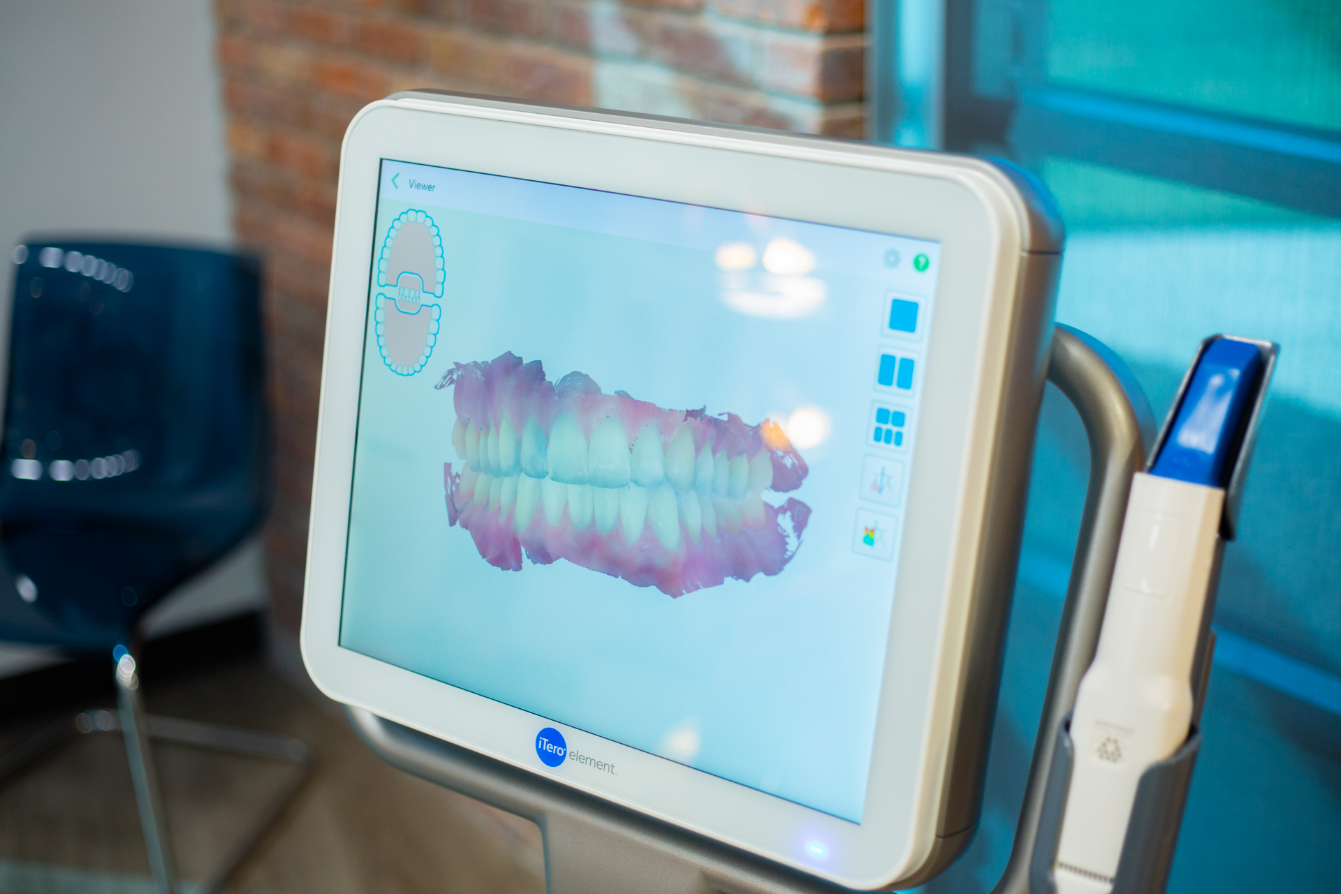 iTero® Digital Scanner | Oread Orthodontics
